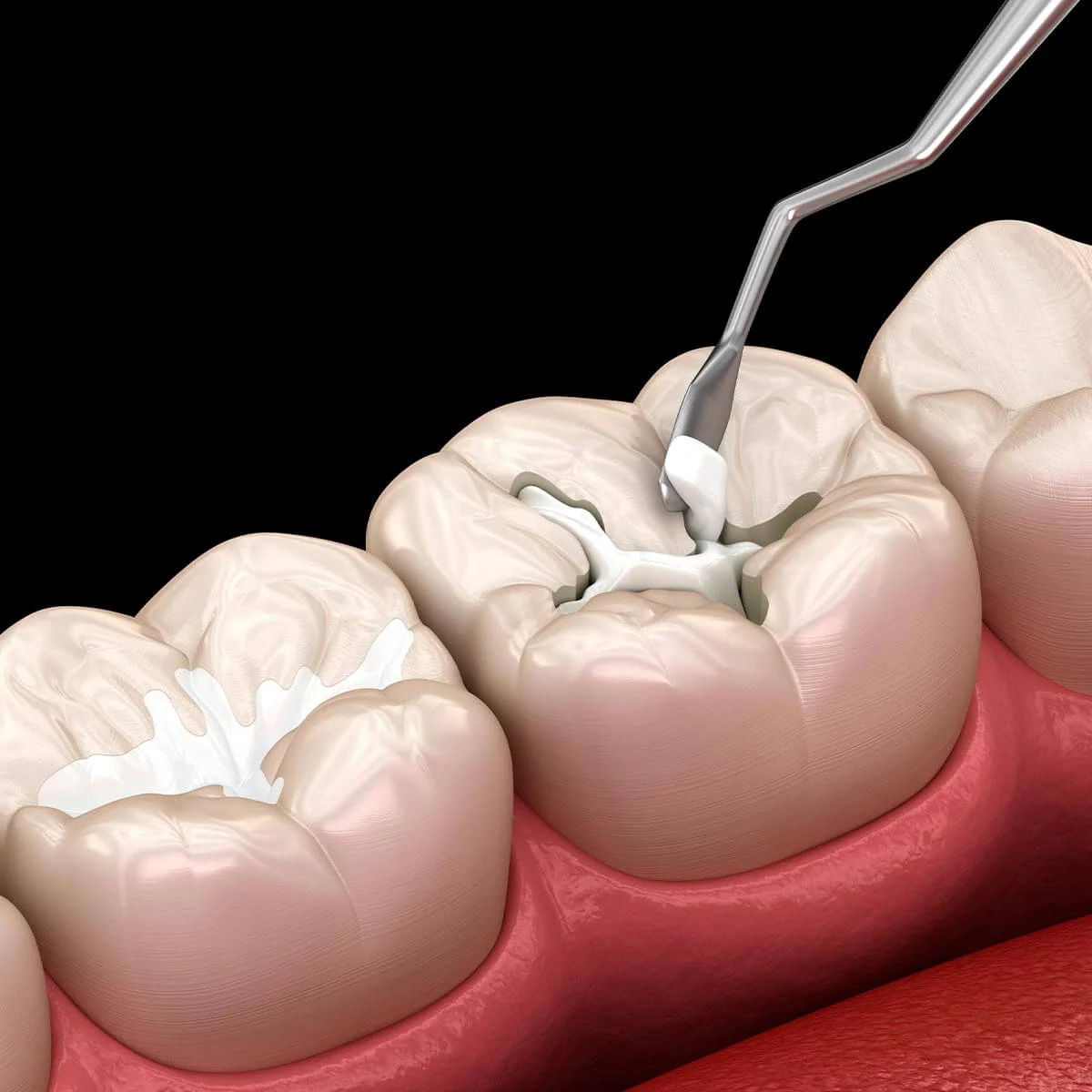 Products - Trisha Dental & Implant Centre